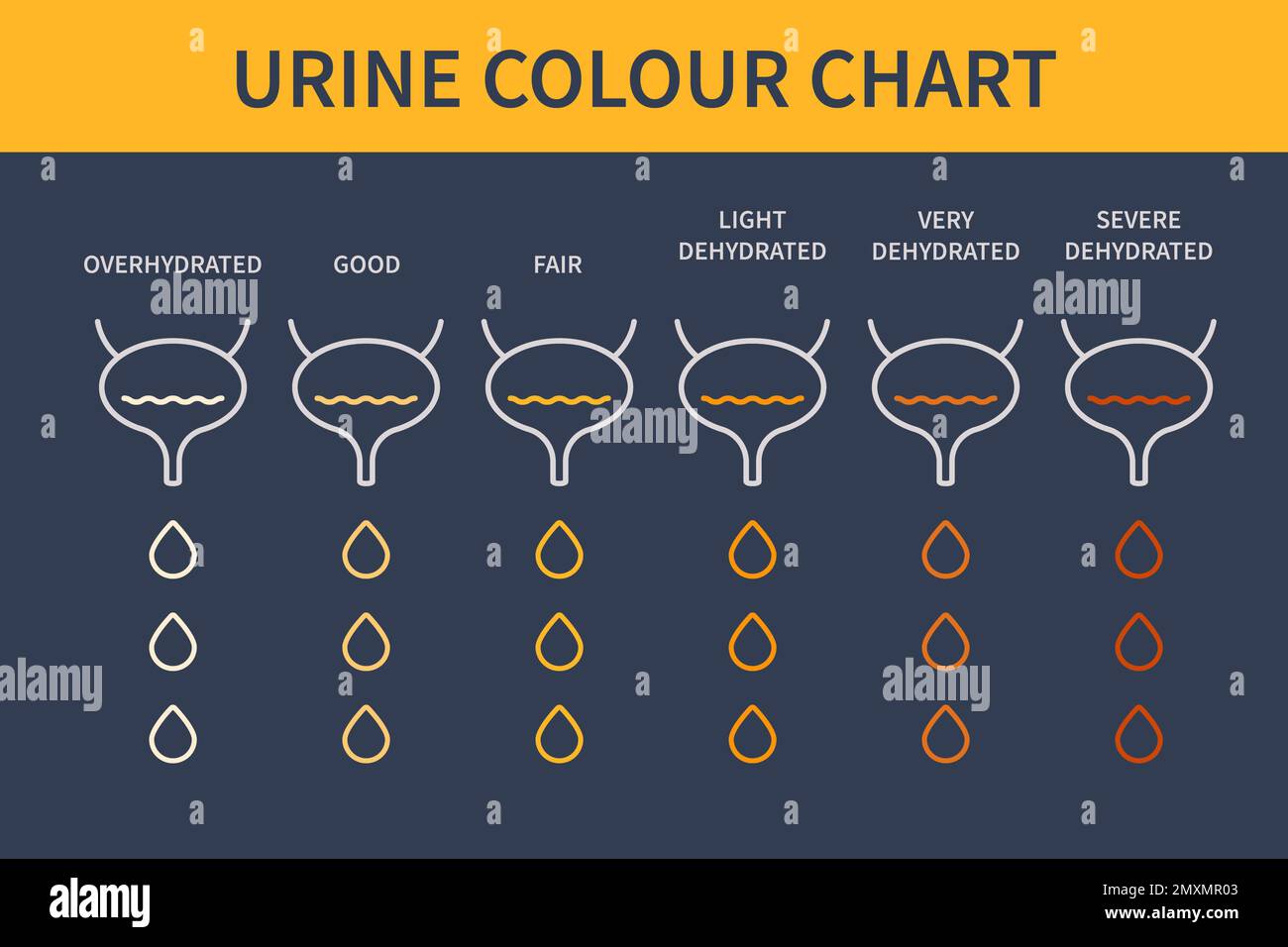 Urine colour chart, illustration Stock Photo - Alamy