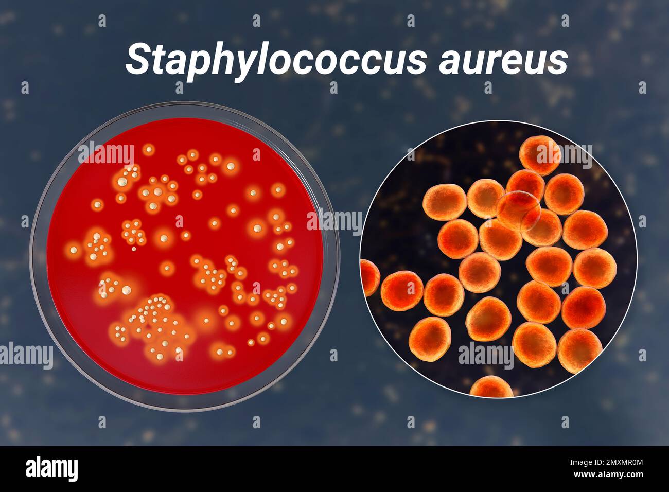 Staphylococcus aureus agar plate hi-res stock photography and images ...