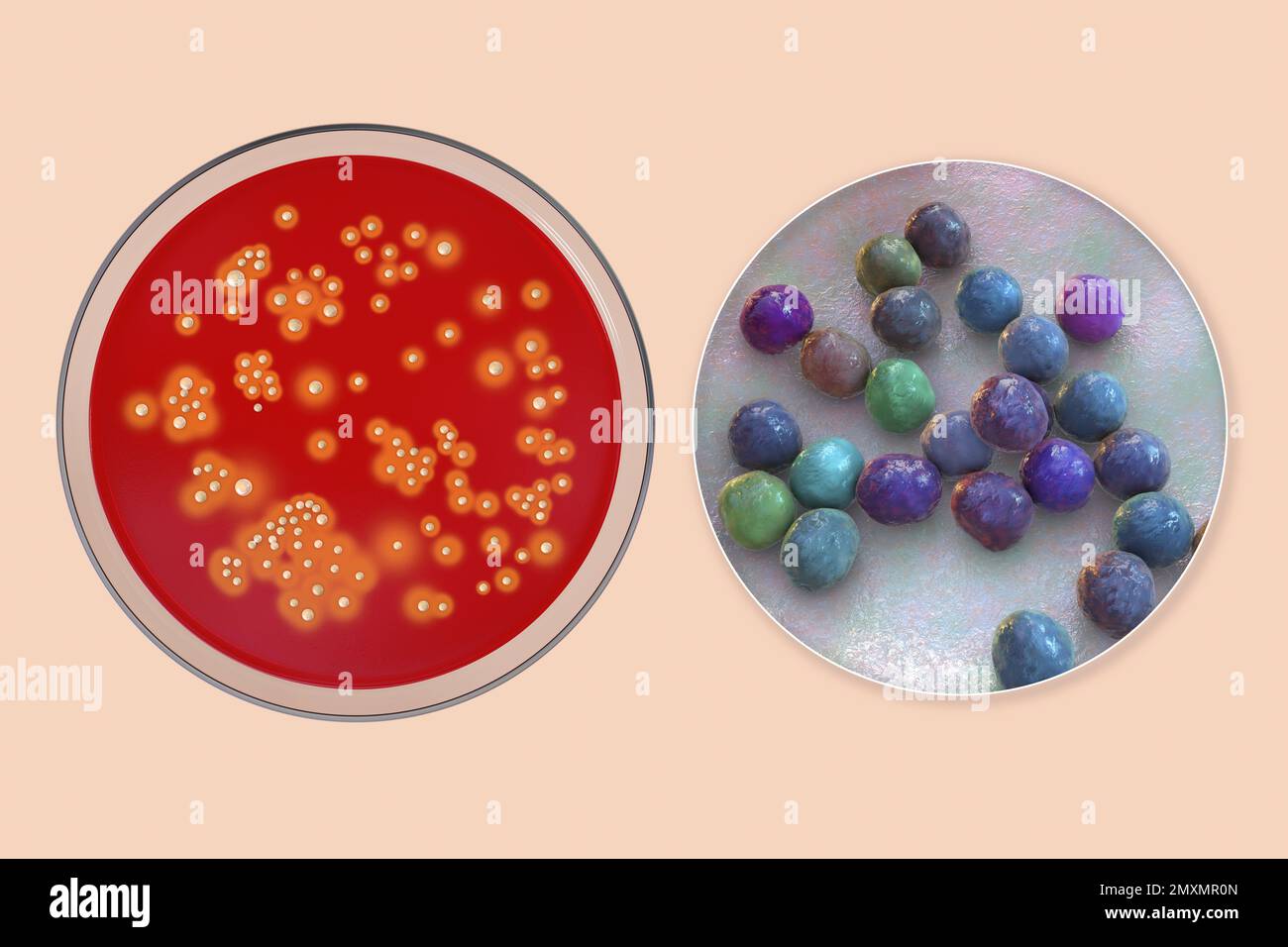 Staphylococcus aureus bacteria, illustration Stock Photo - Alamy Staphylococcus aureus bacteria, illustration Stock Photo - Alamy