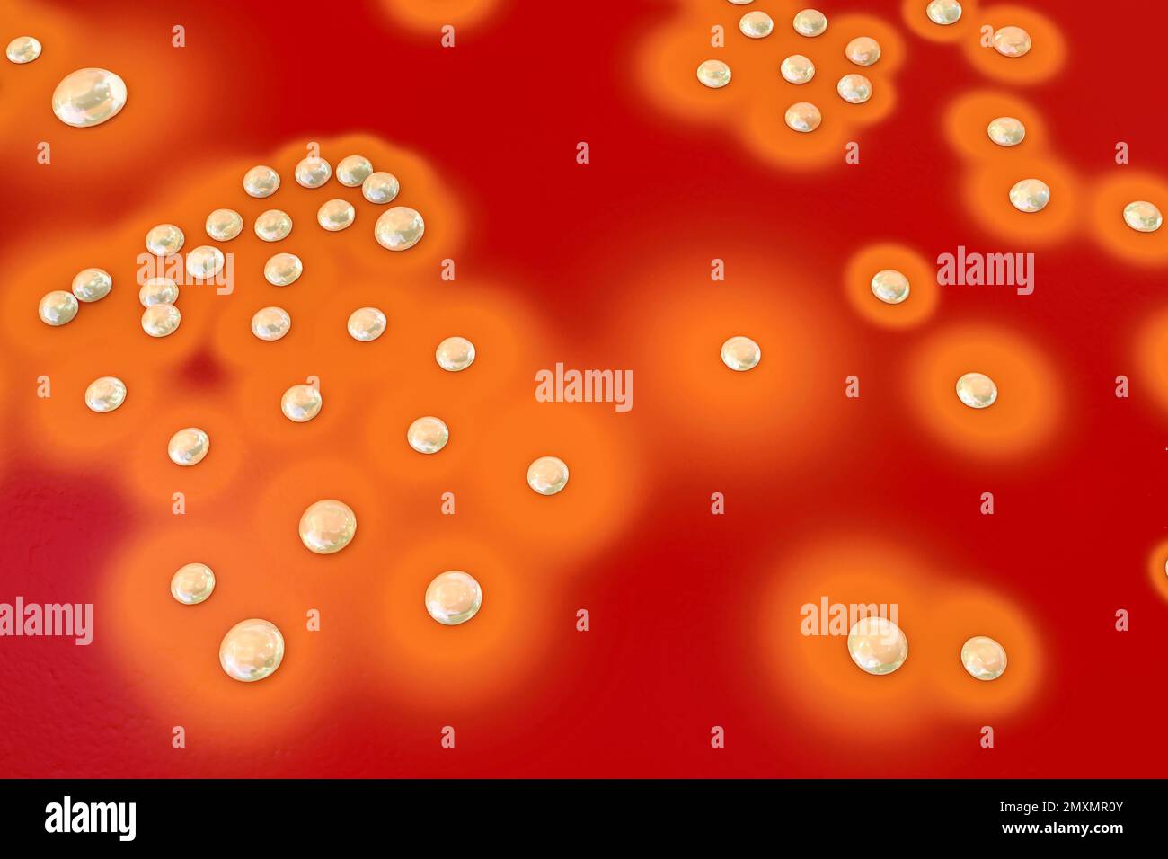 Colonies of Staphylococcus aureus bacteria, illustration Stock Photo ...