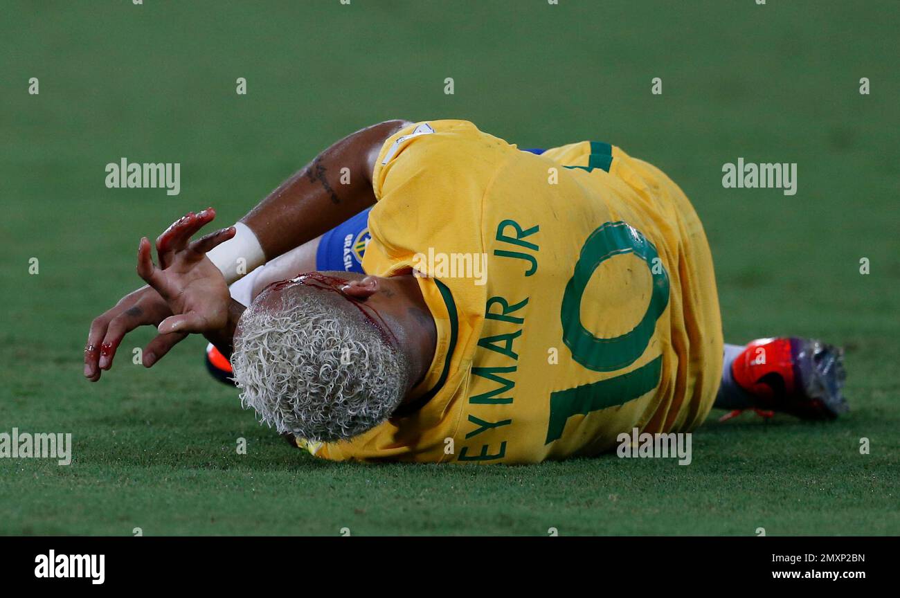 Brazil’s Neymar lies on the pitch with his face bleeding after a rough ...