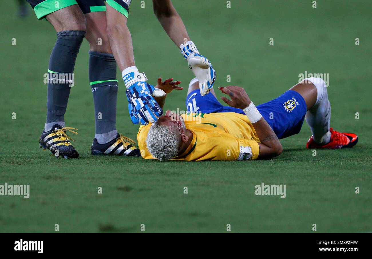 Brazil’s Neymar lies bleeding on the pitch after a rough play during a ...