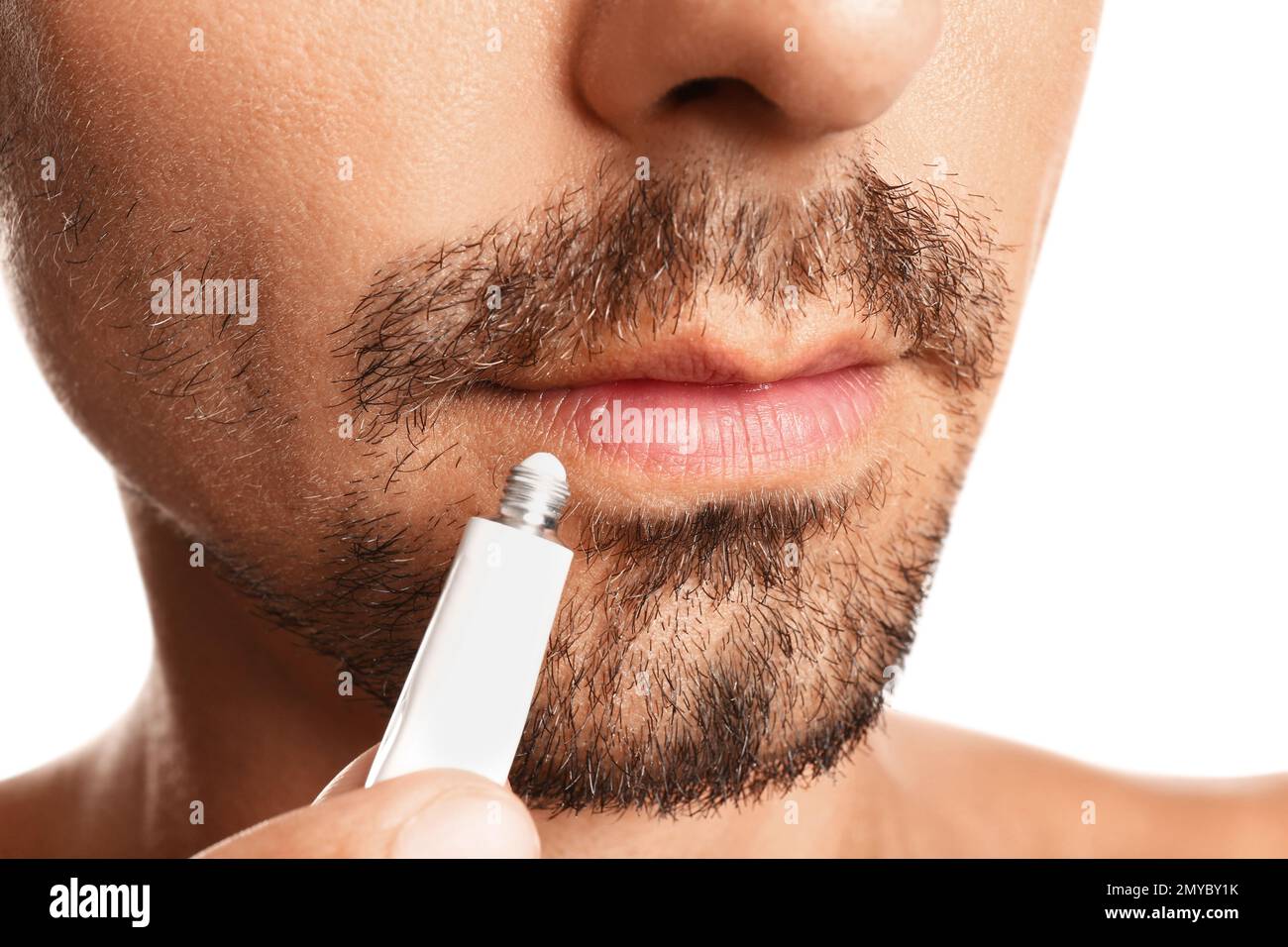 Cold sore cream tube hi-res stock photography and images - Alamy