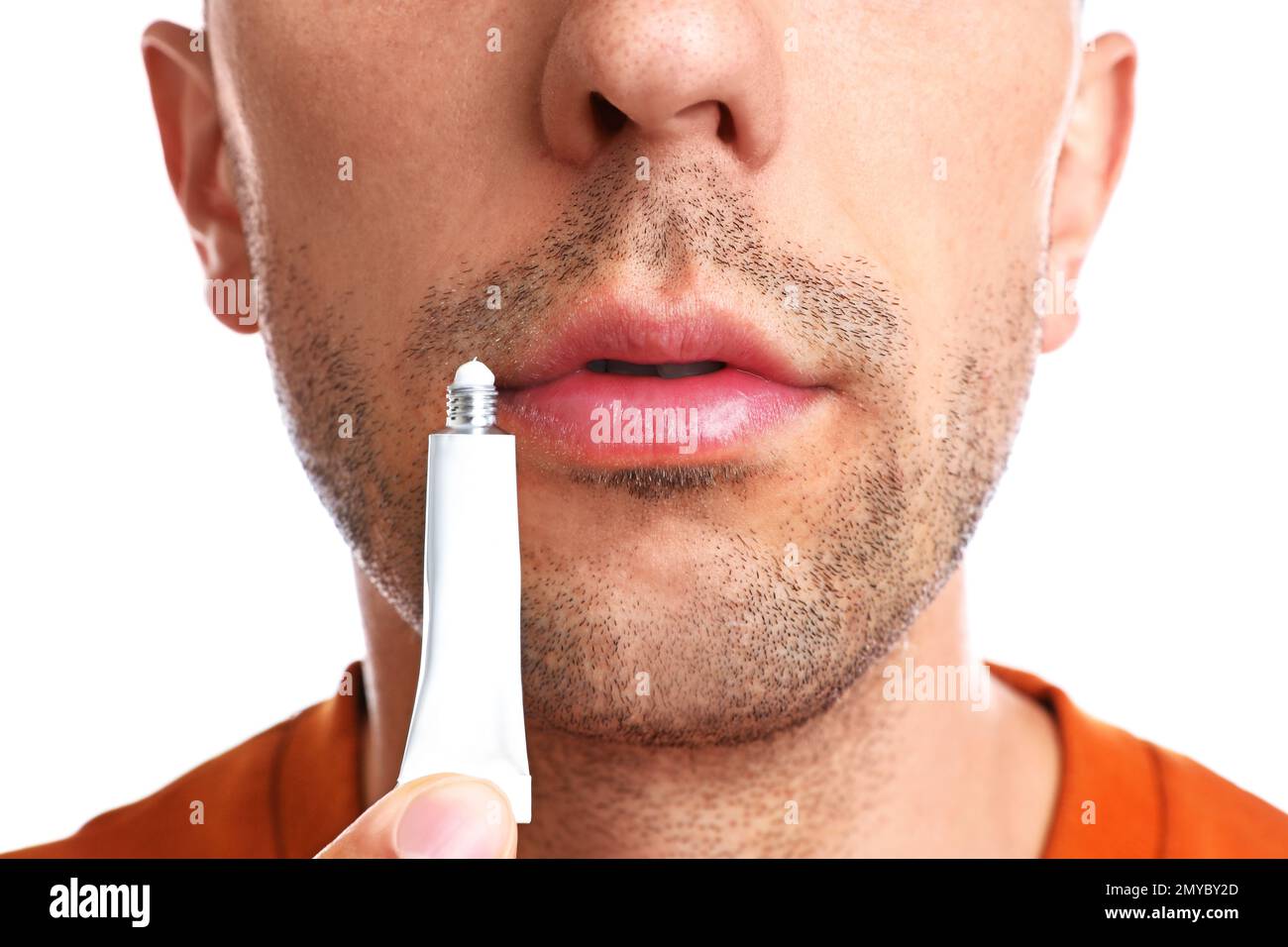 Cold sore cream tube hi-res stock photography and images - Alamy