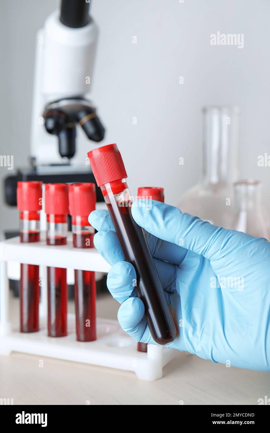 Scientist holding test tube with blood sample near microscope, closeup ...