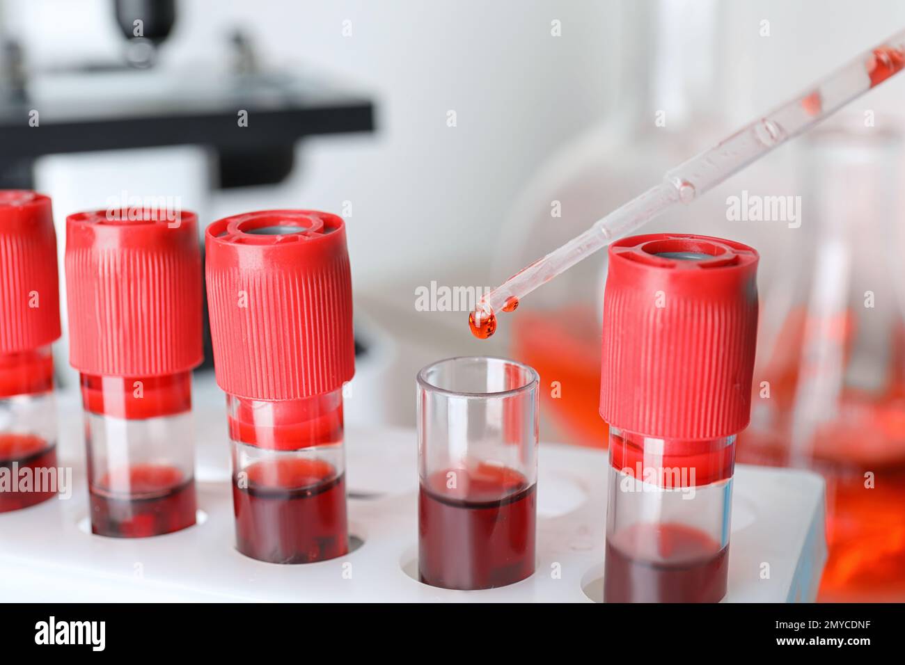 Dripping sample from pipette into test tube, closeup. Laboratory ...