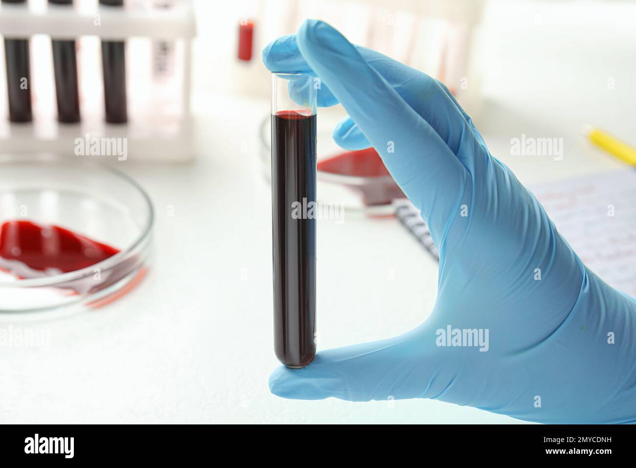 Scientist holding test tube with blood sample, closeup. Laboratory ...