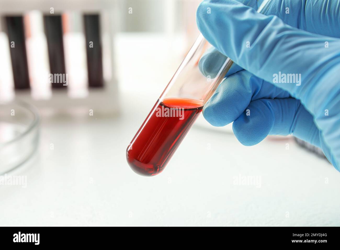 Scientist holding test tube with blood sample, closeup. Laboratory ...