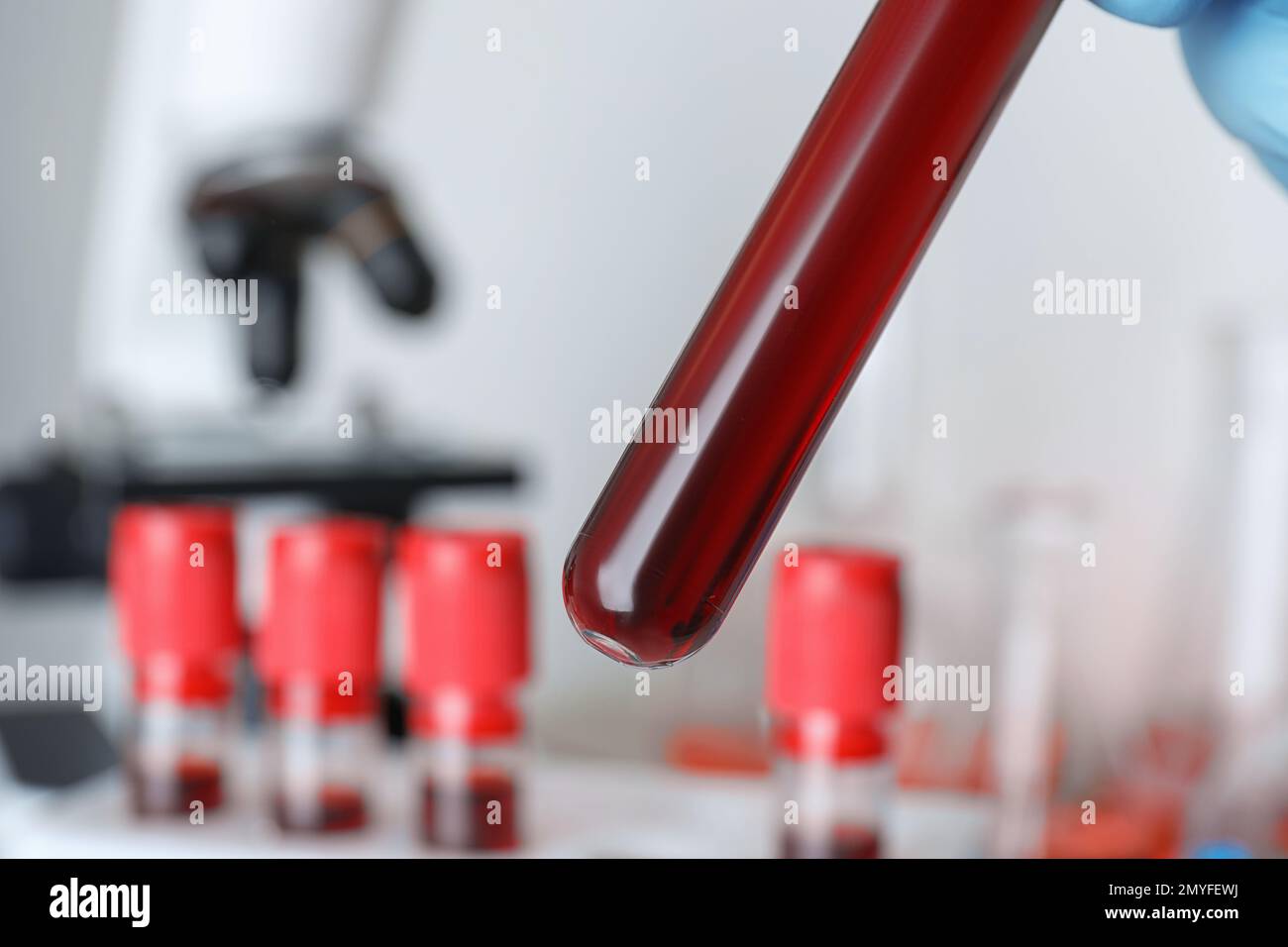 Scientist holding test tube with blood sample, closeup. Laboratory ...