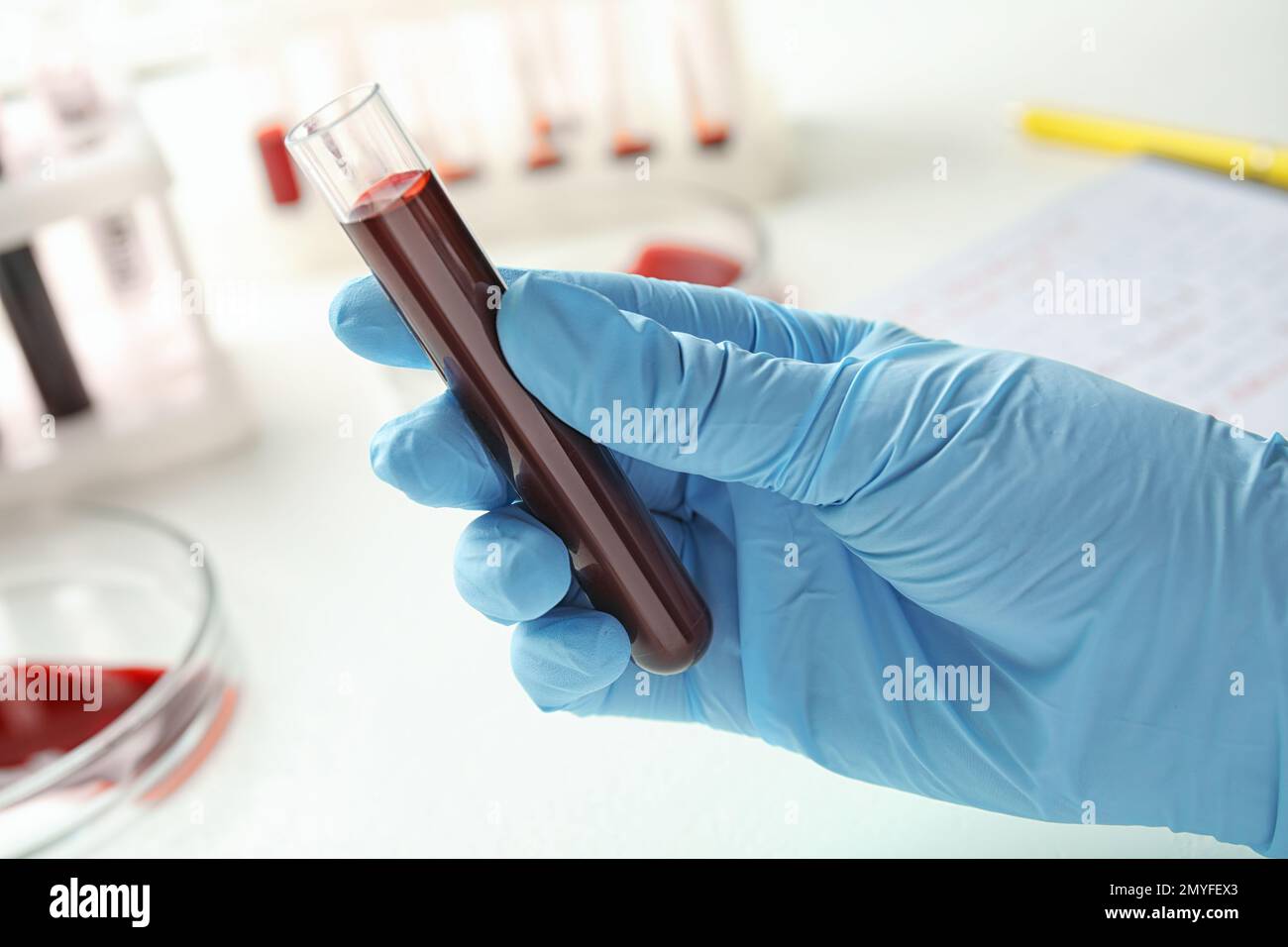 Scientist holding test tube with blood sample, closeup. Laboratory ...