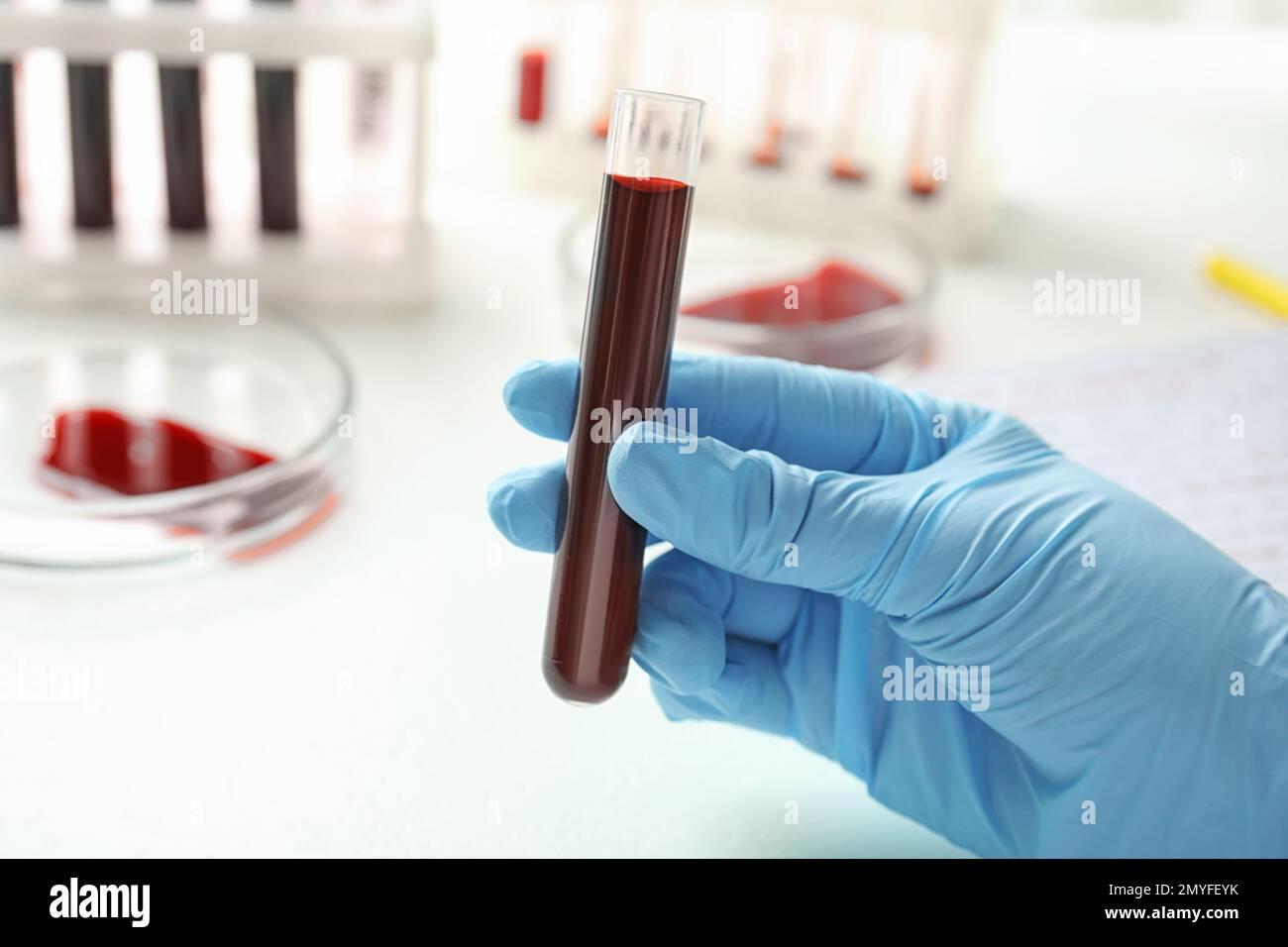 Laboratory assistant holding glass test hi-res stock photography and ...