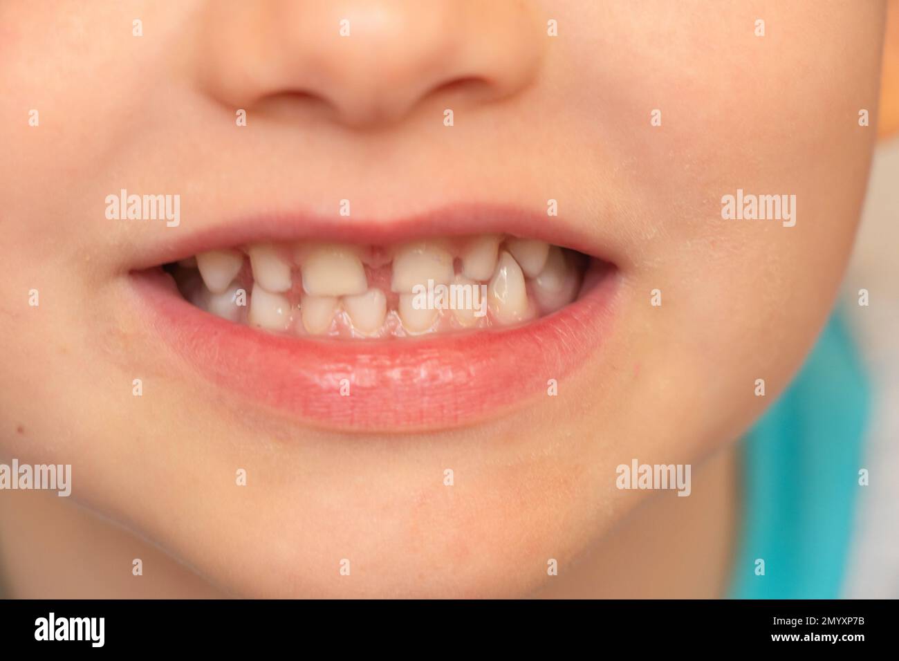 baby white teeth close-up, smiling little boy Stock Photo - Alamy