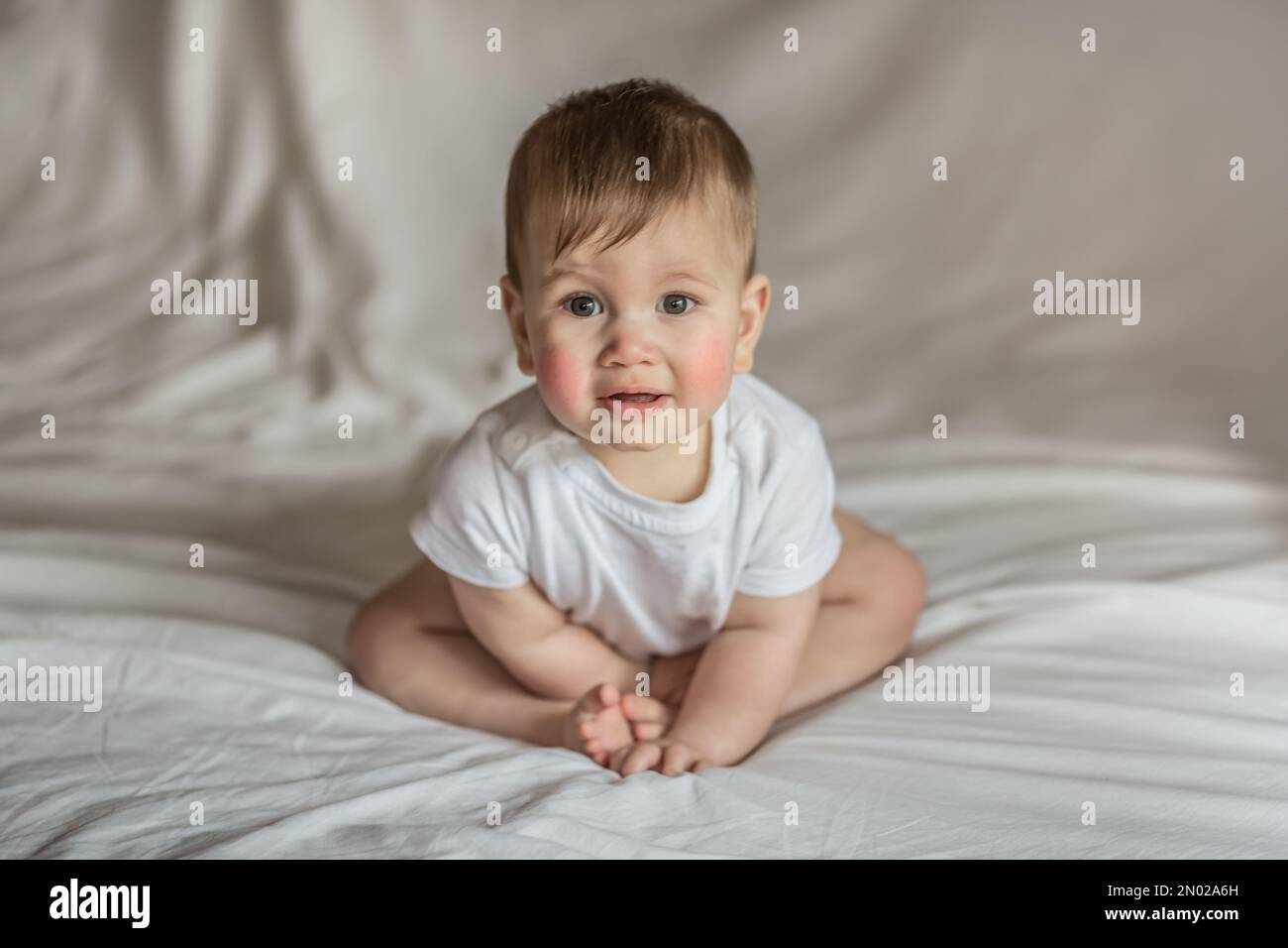 Atopic dermatitis eczema in baby.Condition that causes the skin to ...