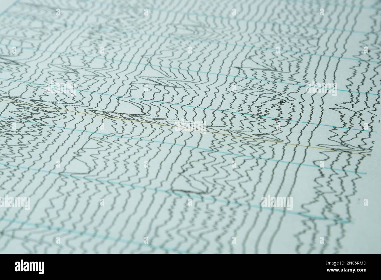 Imaging of brain waves from electroencephalography or EEG in human ...