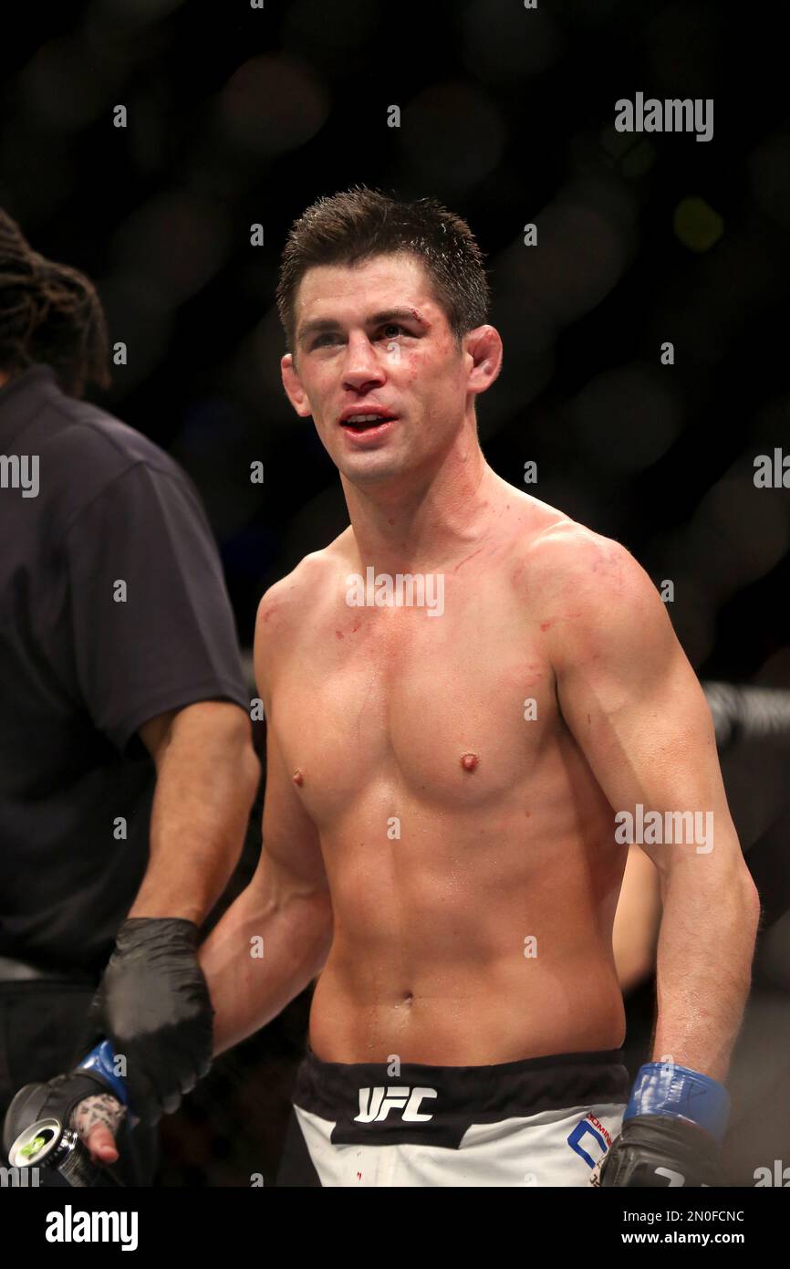 Dominick Cruz is seen after his fight against TJ Dillashaw in their ...