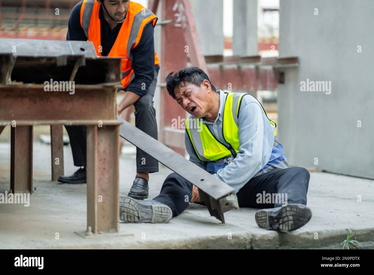 engineer has an accident where steel falls on his leg at work, causing ...