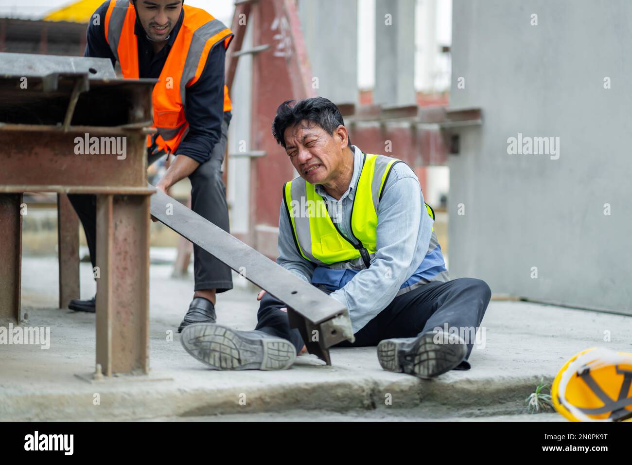 engineer has an accident where steel falls on his leg at work, causing ...