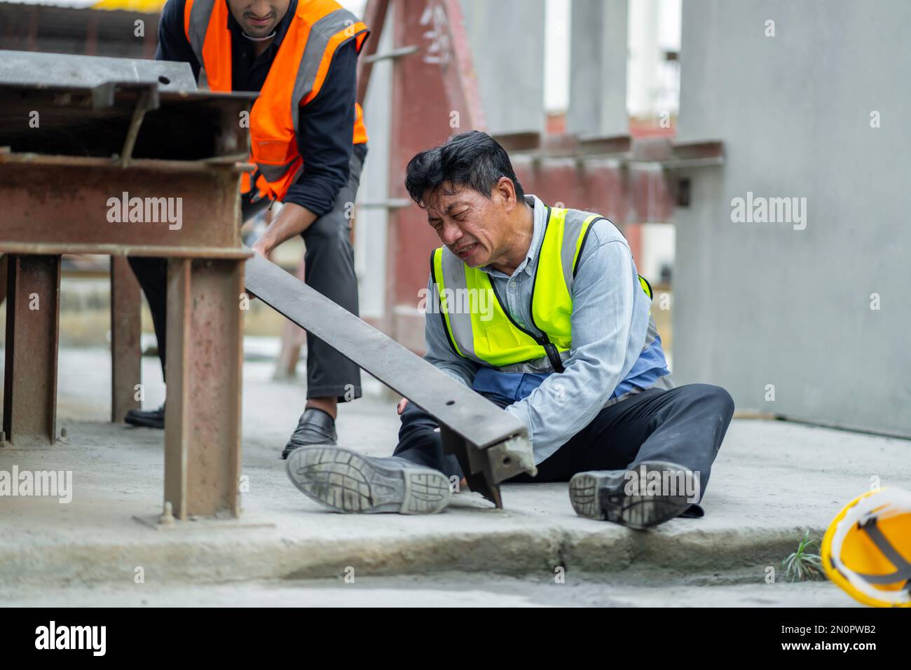 engineer has an accident where steel falls on his leg at work, causing ...