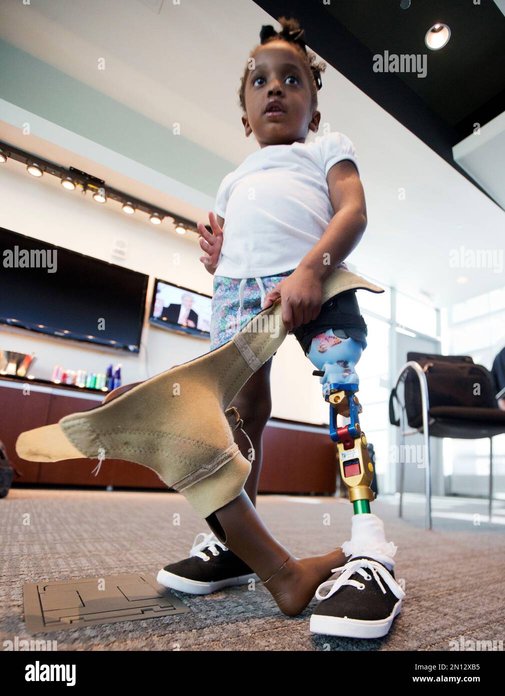 Miyah Williams, 3, holding her old prosthesis, shows her new one she’s ...