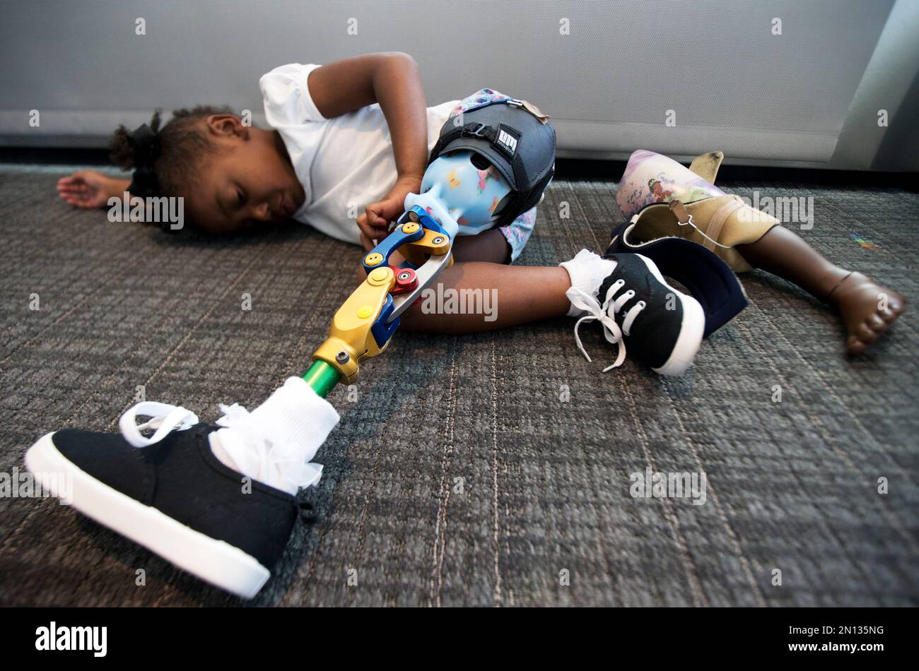 Miyah Williams, 3, wearing her prosthetic leg, rests in Washington ...