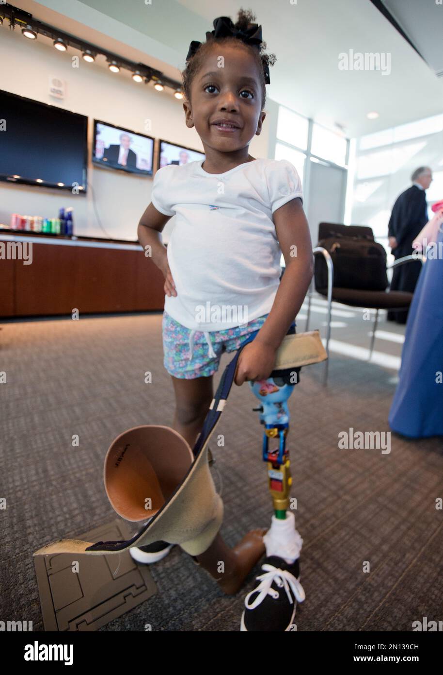 Miyah Williams, 3, holds her old prosthetic leg while showing off a new ...