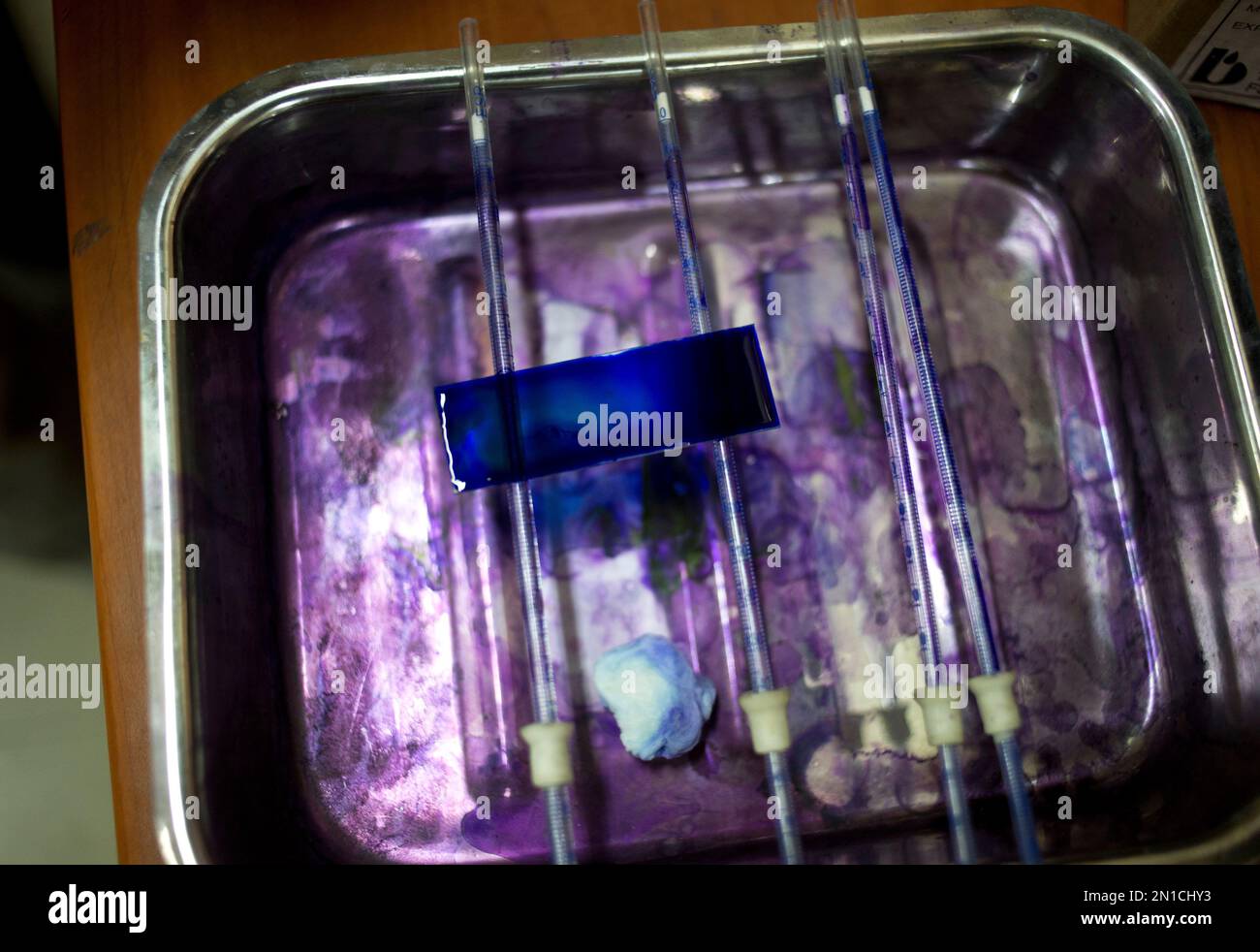 A dyed slide lies before being washed and seen under a microscope to ...