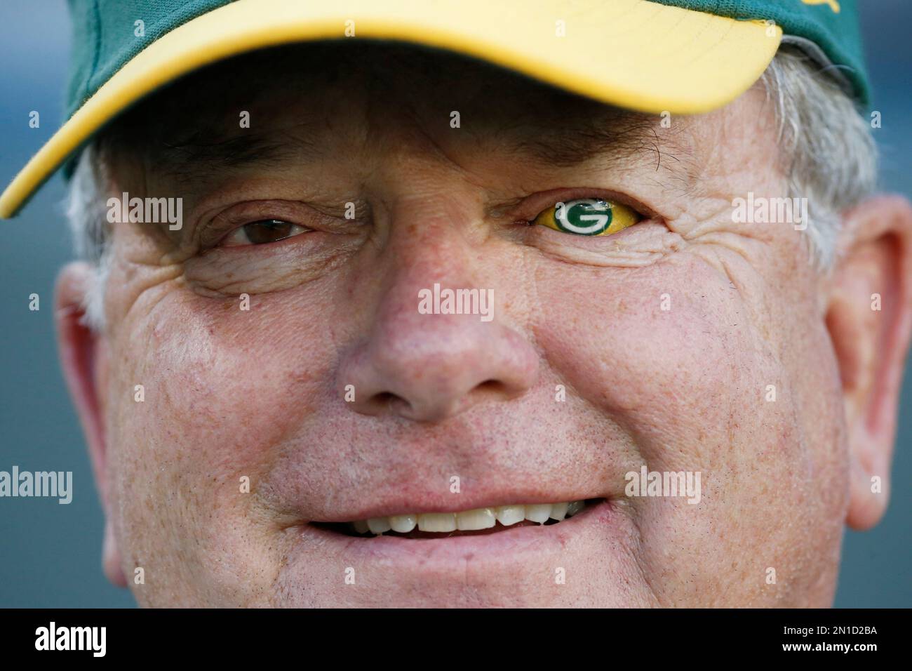 Green Bay Packers fan shows off his prosthetic eye before an NFL ...