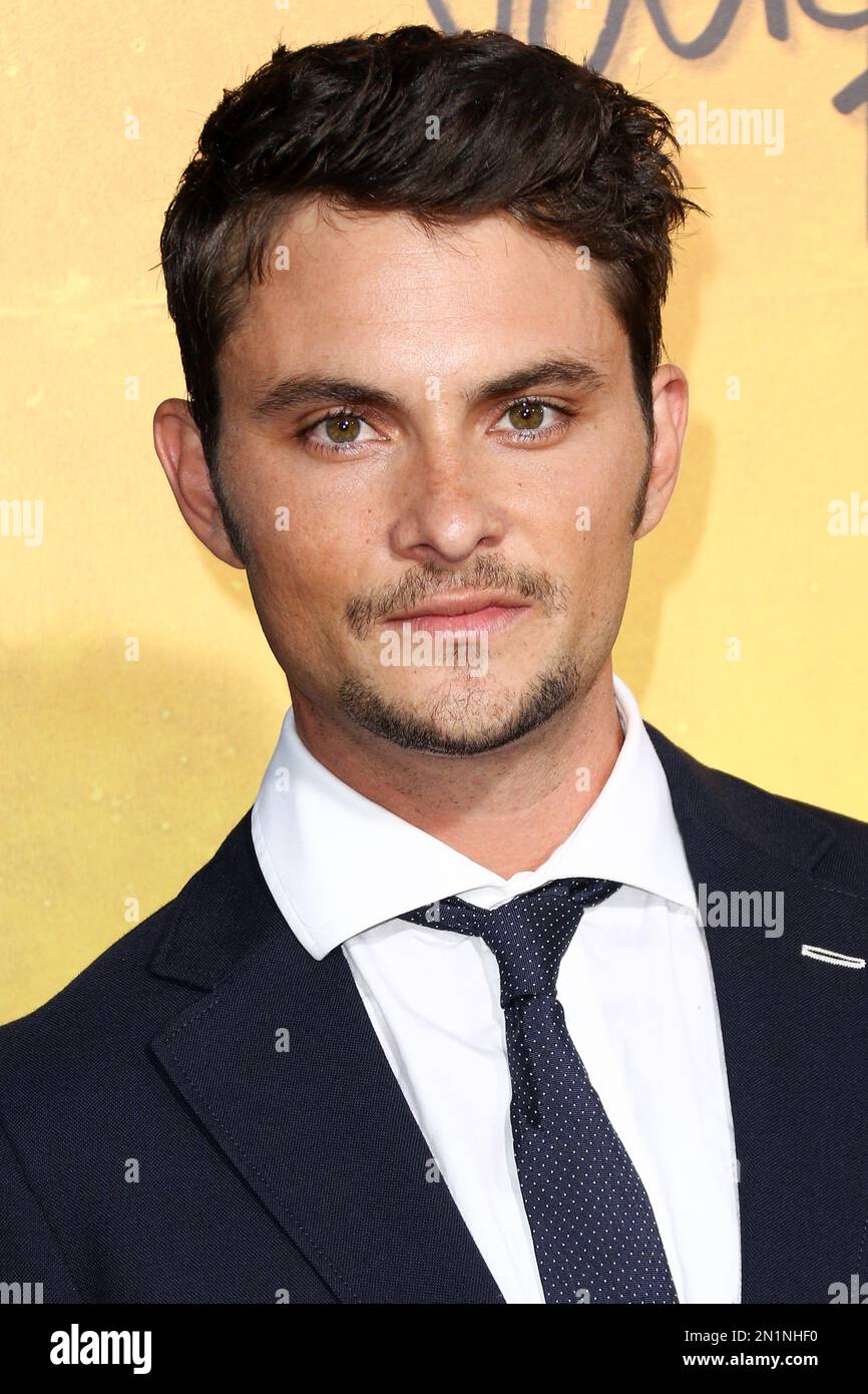 Shiloh Fernandez Black Eye
