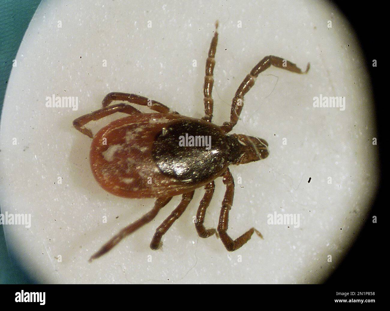FILE - This March 2002 file photo shows a deer tick under a microscope ...