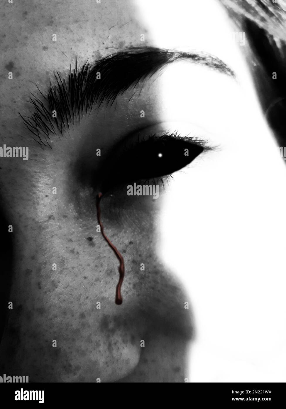 A vertical closeup shot of a female's face with the eye bleeding in ...