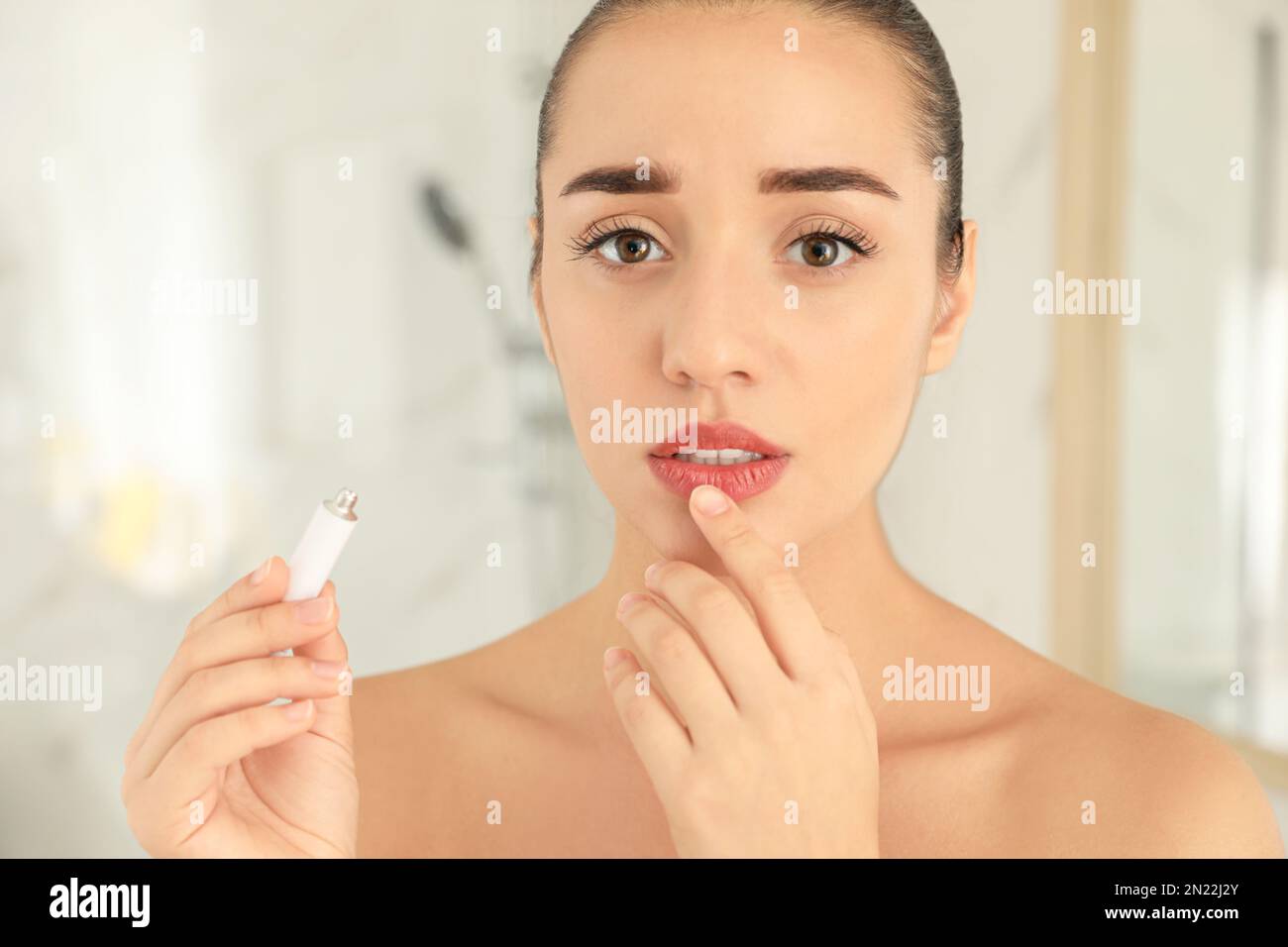 Woman with herpes applying cream on lips against blurred background ...
