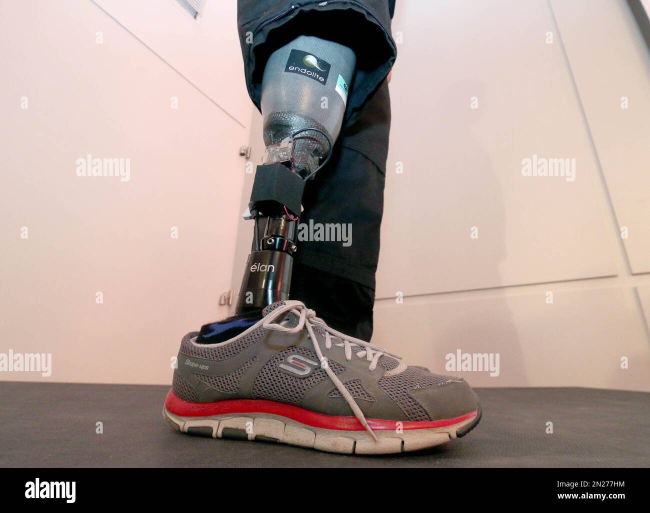 Wolfgang Rangger present his sentient artificial leg in Vienna, Austria ...