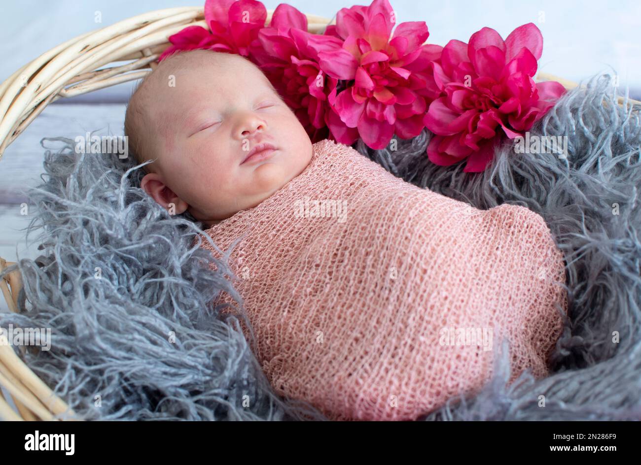 Stork Bite Birthmark Forehead