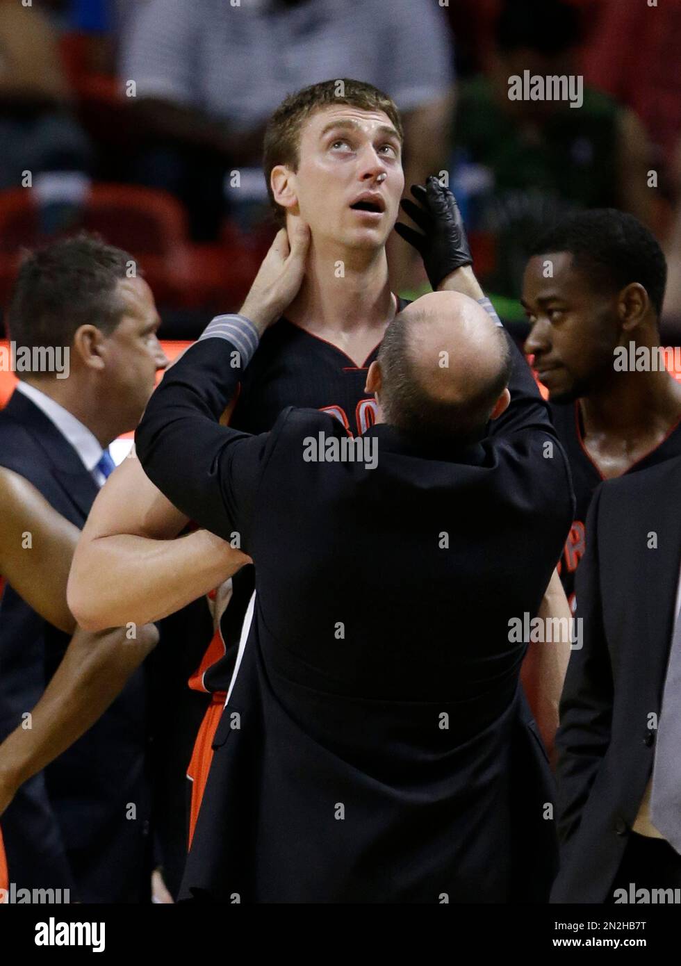 Tyler Hansbrough Nose