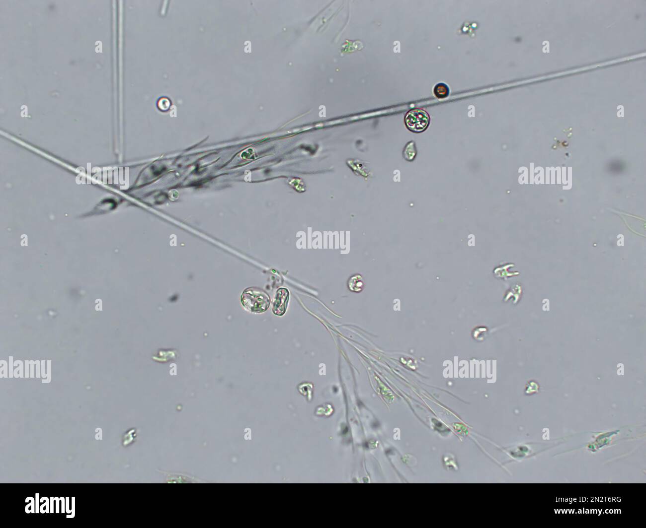 Diatoms, algae under microscopic view, phytoplankton, fossils, silica ...
