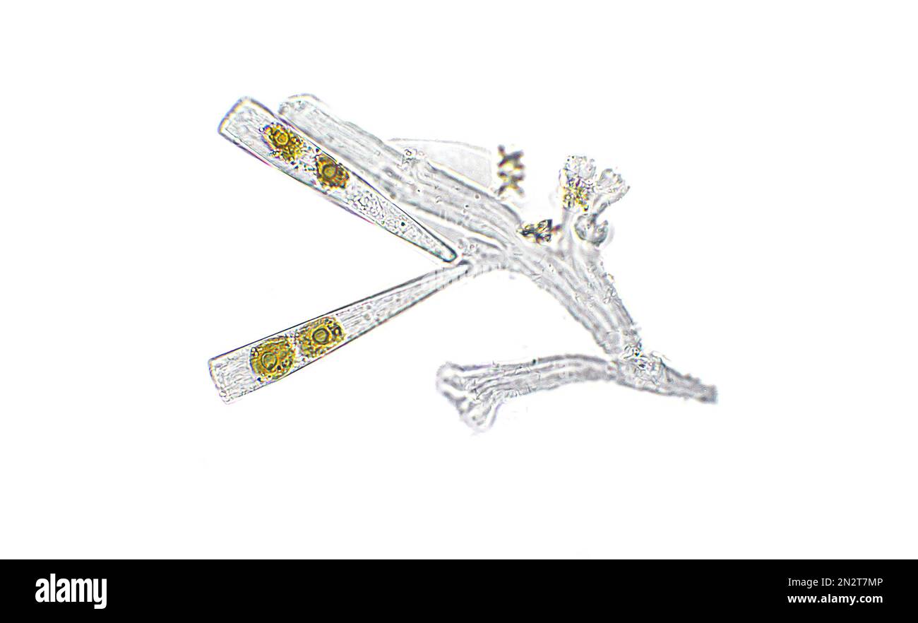 Licmophora sp. algae under microscopic view, diatoms, phytoplankton ...