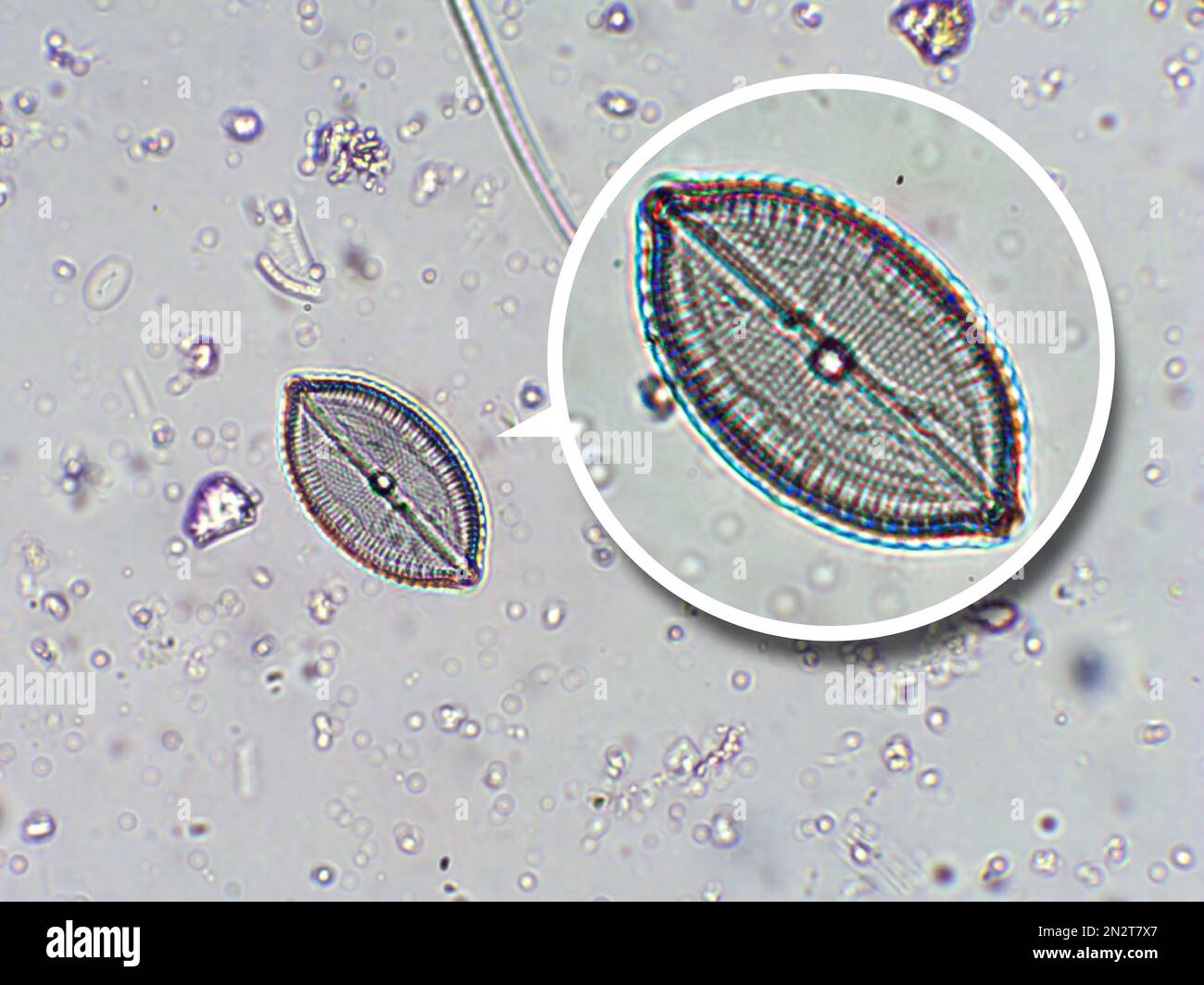 Diatom algae microscopy hi-res stock photography and images - Alamy Diatom algae microscopy hi-res stock photography and images - Alamy