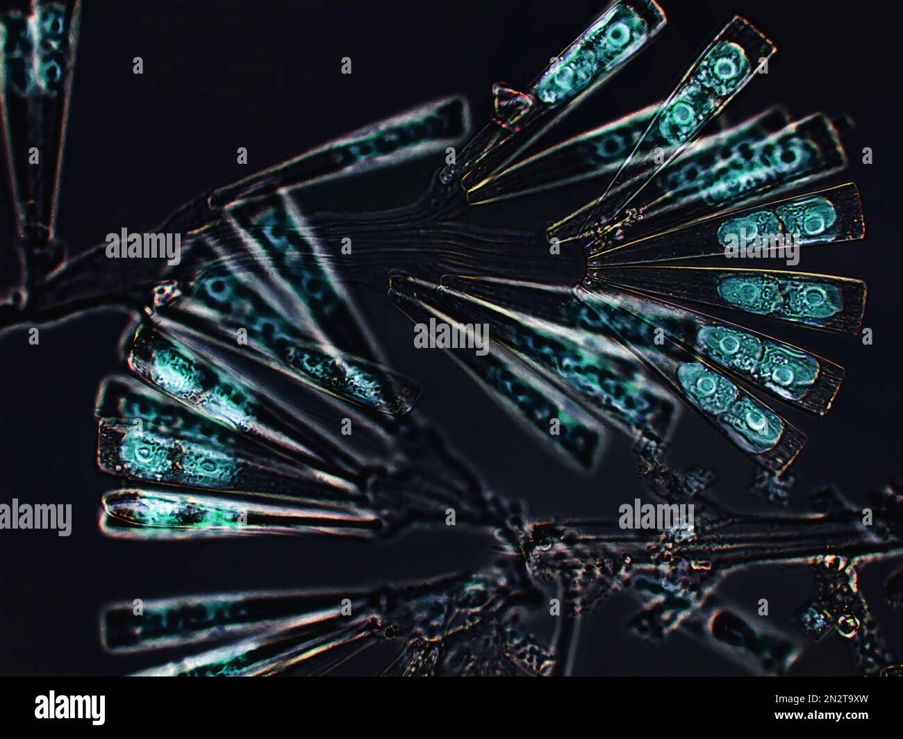 Microorganism or cells, algae cells under microscope. Microbiology ...