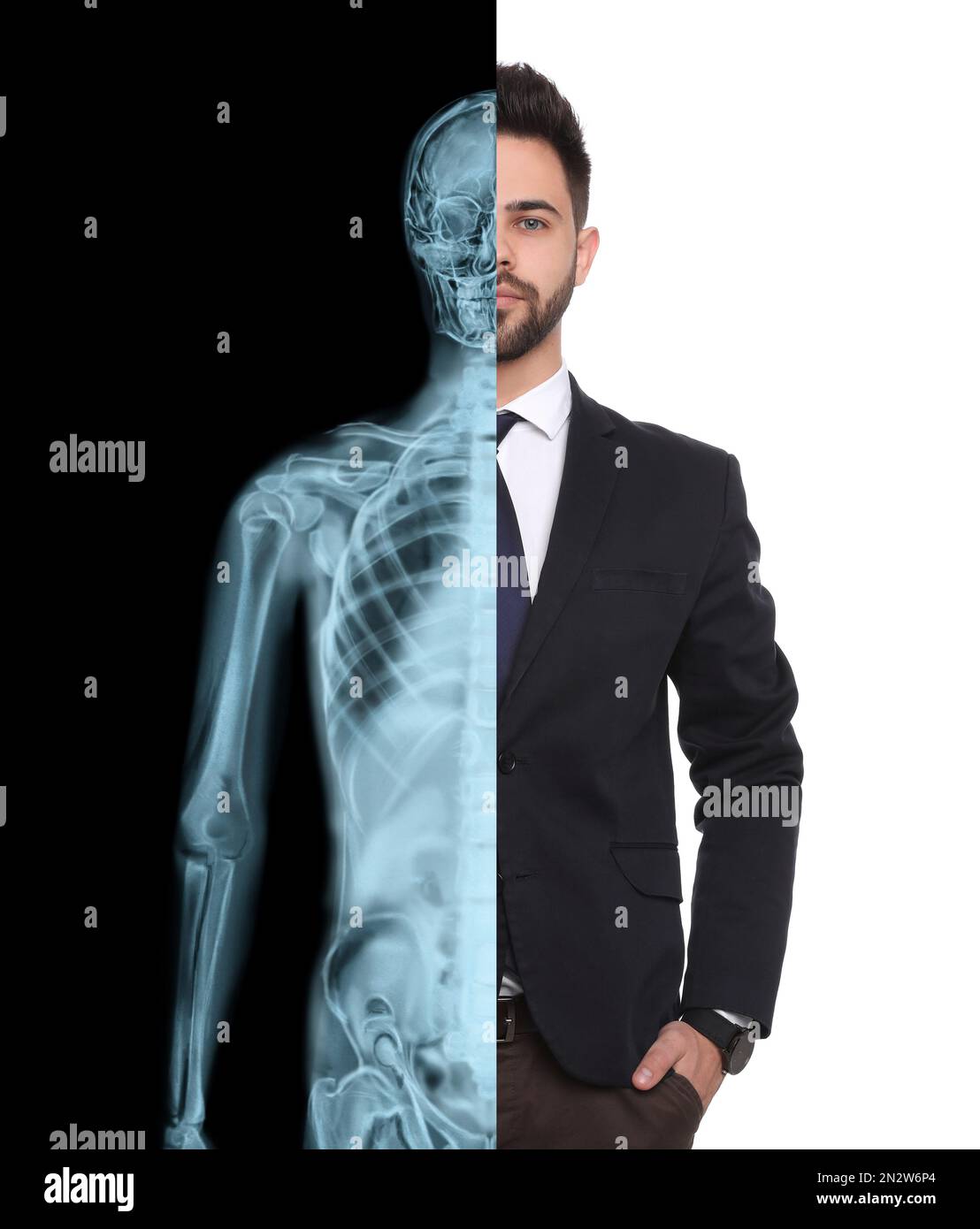 Man in suit, half x-ray photograph. Medical check Stock Photo - Alamy