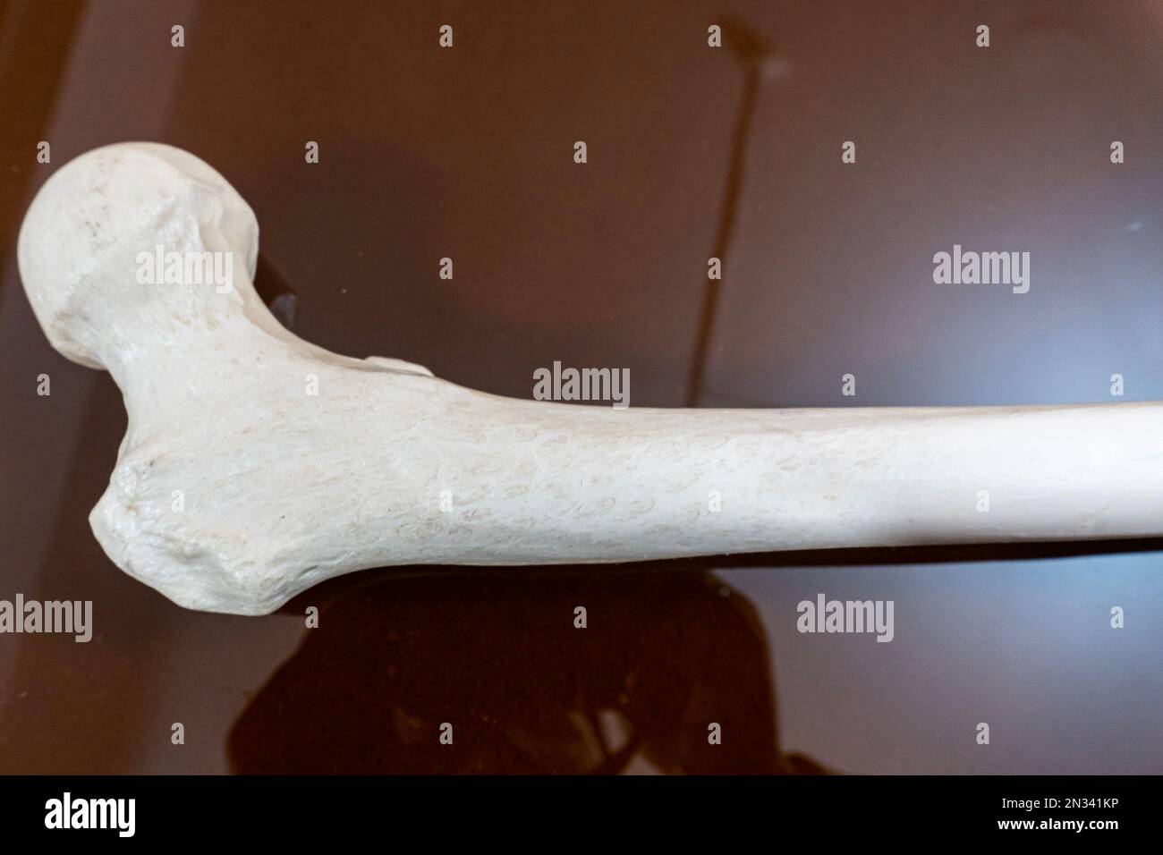 Human bone marrow hi-res stock photography and images - Alamy