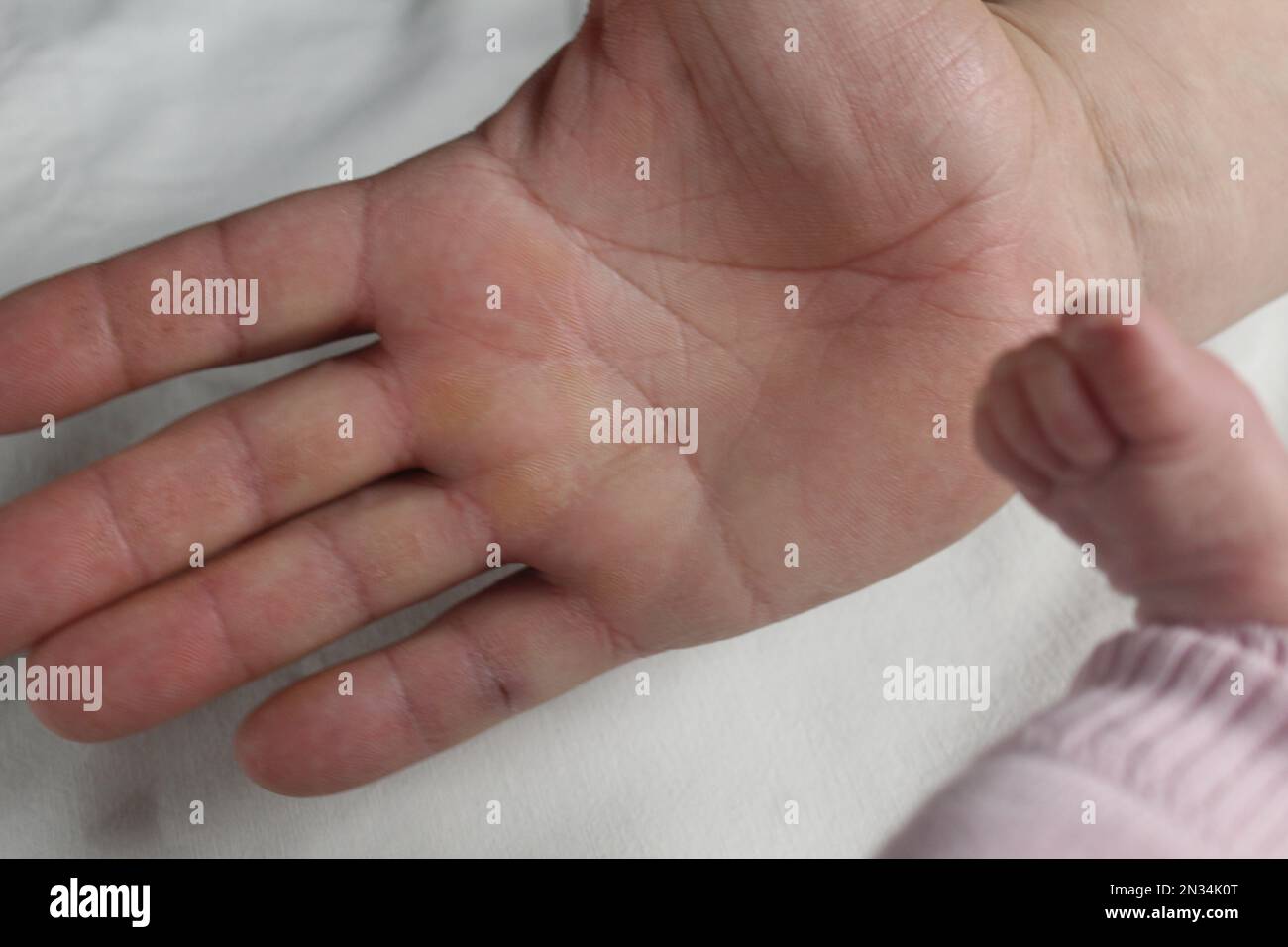 a small leg of a baby born on the arm of a man's father in close-up ...