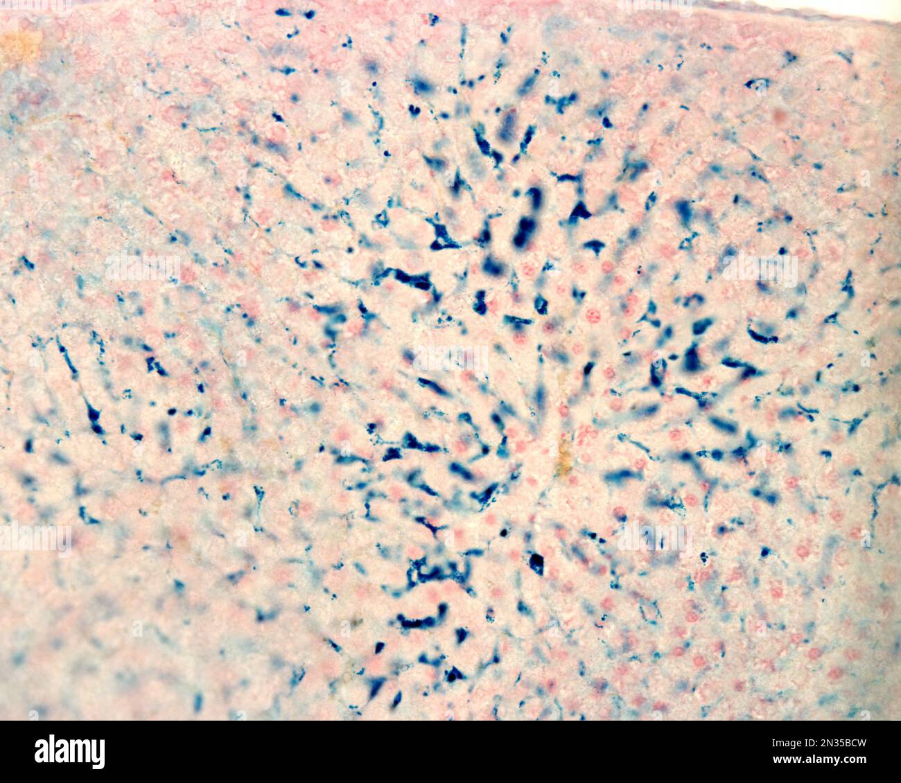 Liver Histology Kupffer Cells