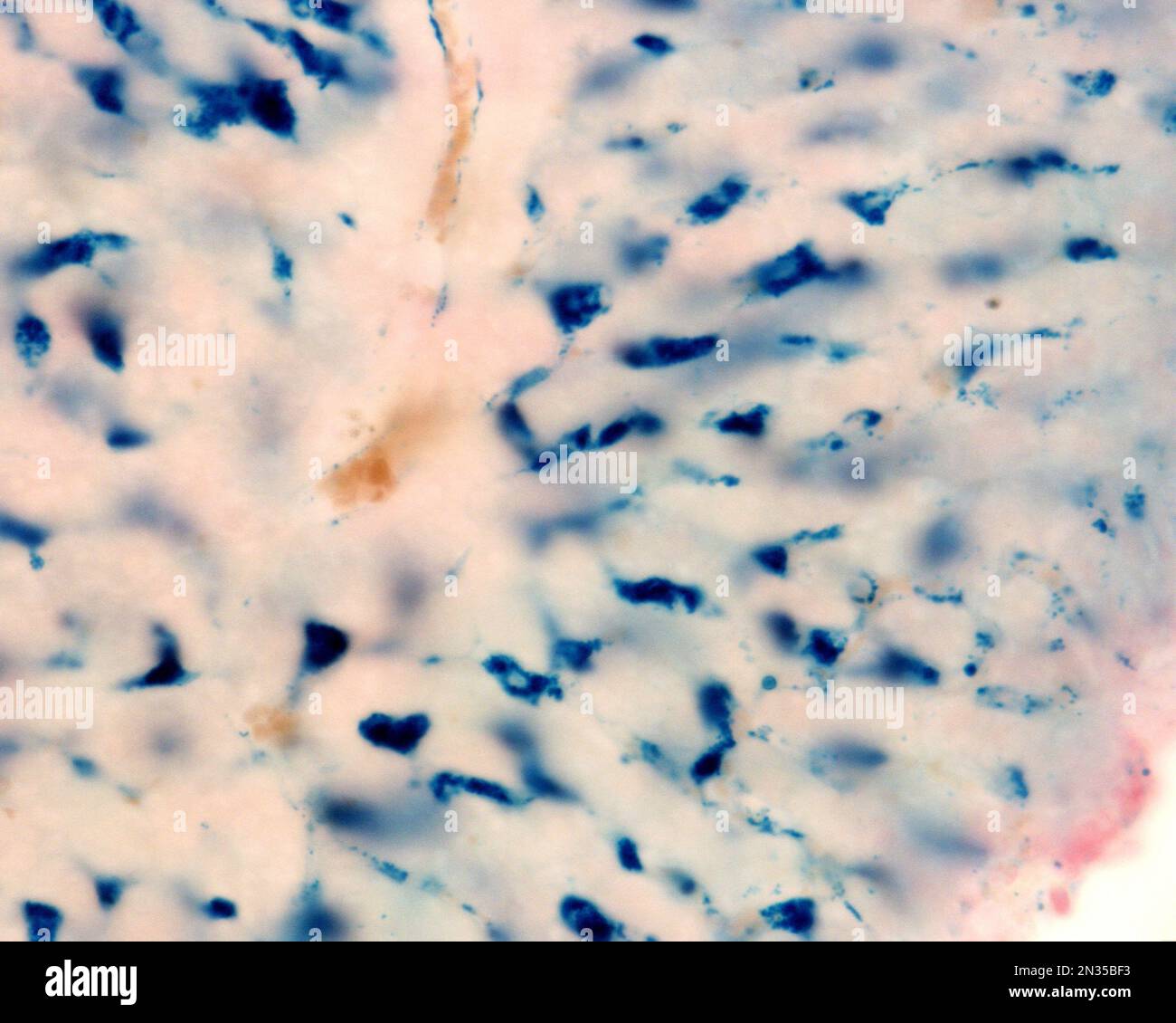 Kupffer Cells Are Macrophages Of The Liver Colloidal Iron Acts As A Vital Stain That Can Be