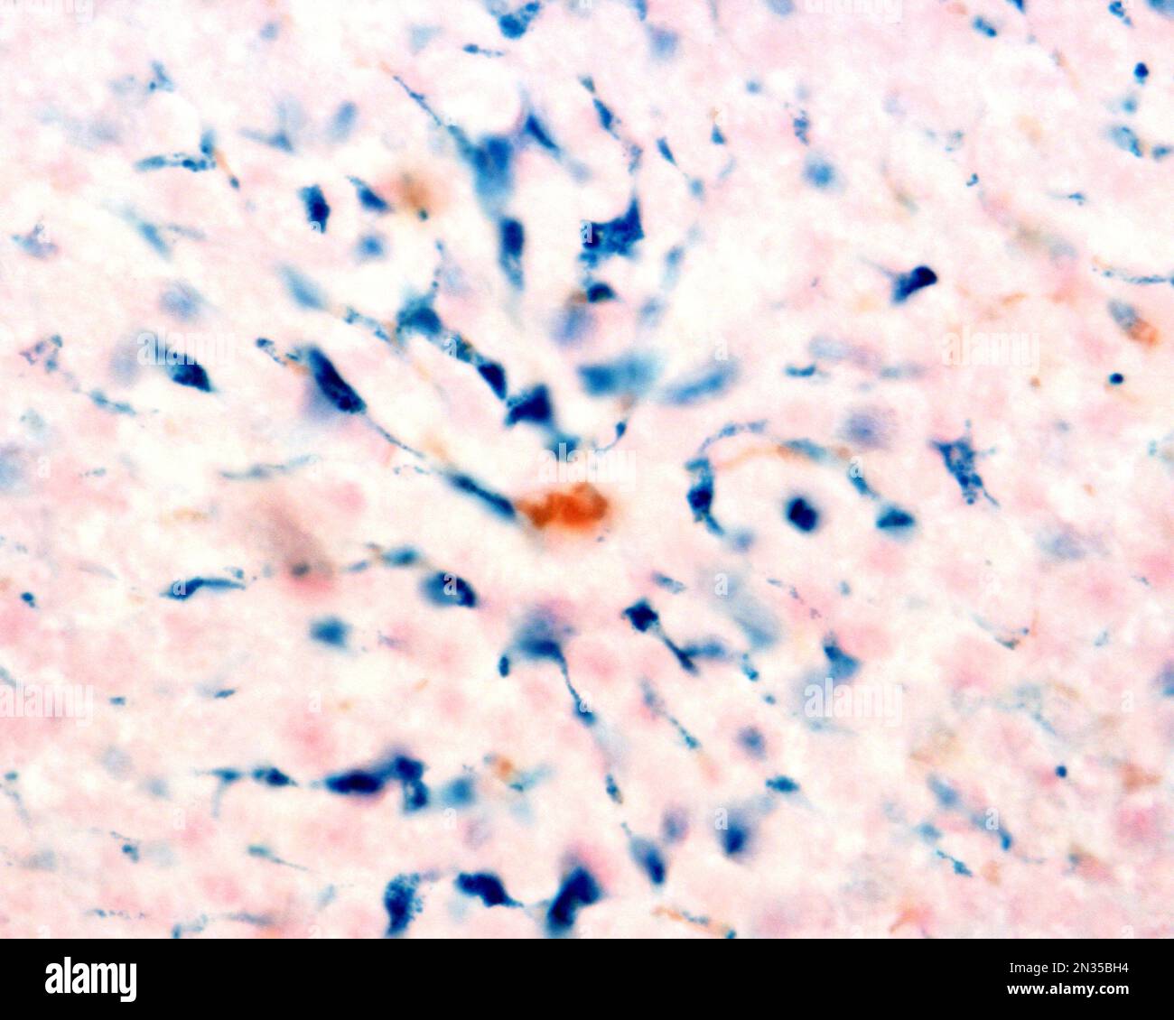 Kupffer cells are macrophages of the liver. Colloidal iron acts as a ...