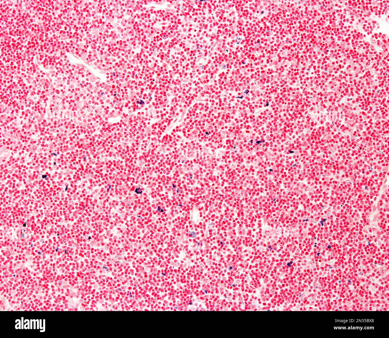 Trypan blue is a vital stain that can be introduced in the body ...