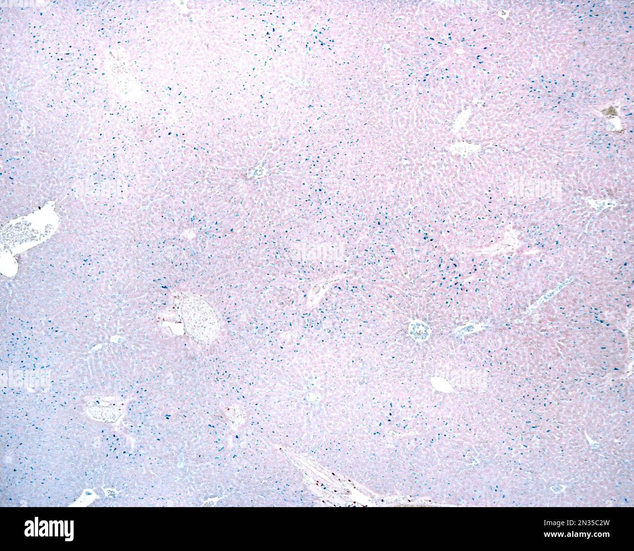 Low magnification micrograph of a liver showing Kupffer cells labelled ...