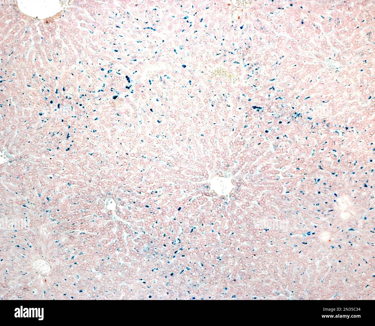 Micrograph healthy liver cells hi-res stock photography and images - Alamy
