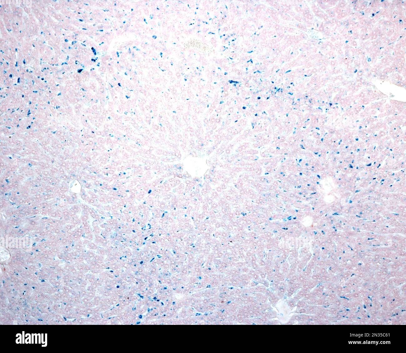 Liver Kupffer Cells Are Macrophages Related To The Liver Sinusoids