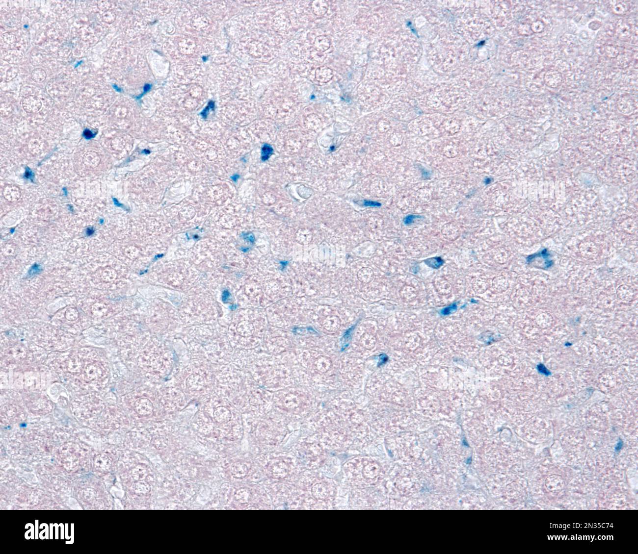 Liver Kupffer cells are macrophages related to the liver sinusoids ...
