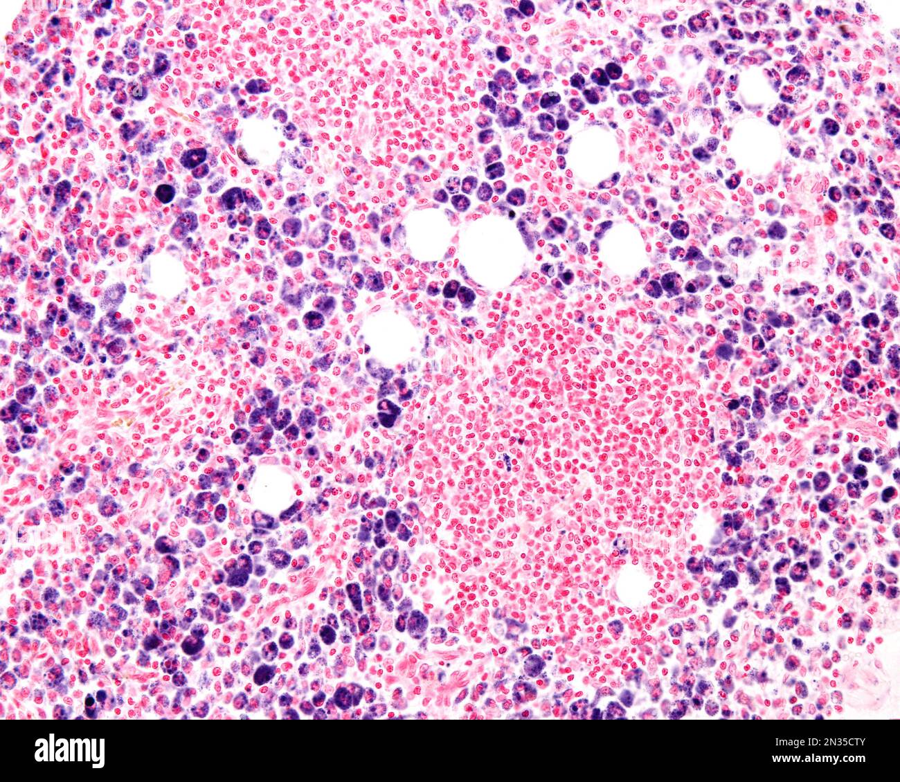 Macrophage Cell Histology